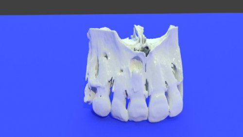 UR1 - stl file processed - Dental, Orthodontic, Maxillofacial ...