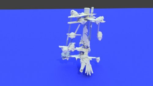 leg - stl file processed - Extremity, Lower (Leg) - embodi3D.com