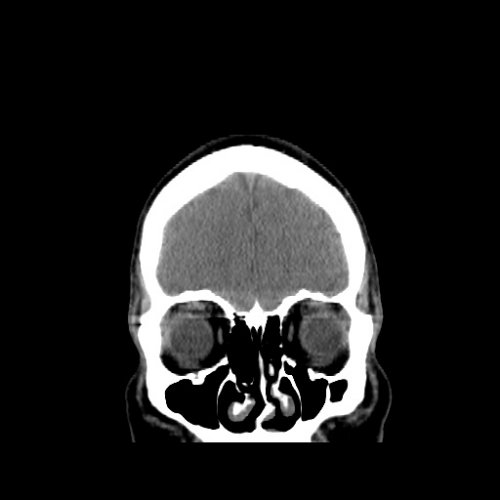 CT HEAD SCAN - democratiz3D® Processing - embodi3D.com