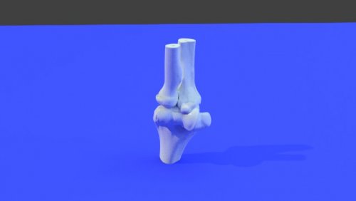 My Elbow CT 1 - stl file processed - Extremity, Upper (Arm) - embodi3D.com