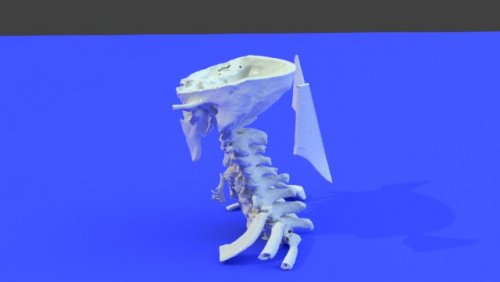 Neck scan - stl file processed - Spine and Pelvis - embodi3D.com