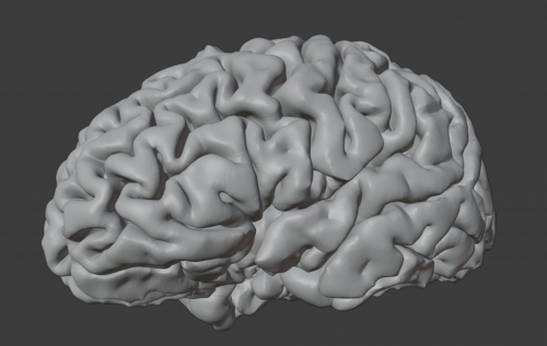 3d Printable Brain from MRI Scan - MRIs - embodi3D.com
