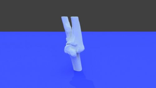 My Elbow CT - stl file processed - Extremity, Upper (Arm) - embodi3D.com