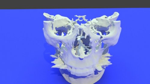 test - stl file processed - democratiz3D® Processing - embodi3D.com