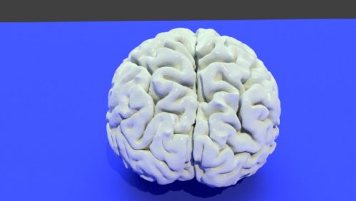 3d Printable Brain from MRI Scan - MRIs - embodi3D.com