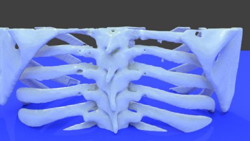 multifile1 - stl file processed - Thorax and Ribs - embodi3D.com