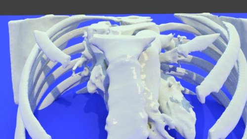 multifile1 - stl file processed - Thorax and Ribs - embodi3D.com