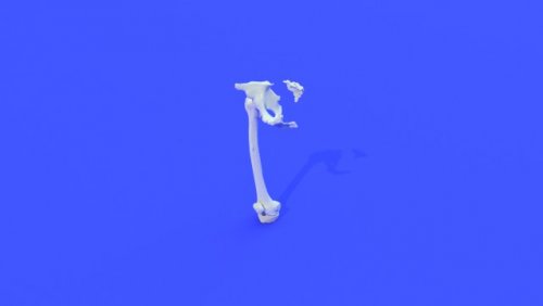 Femur Bone - stl file processed - Lower Extremity CTs - embodi3D.com