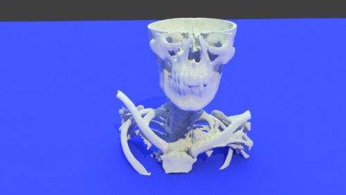 neck - stl file processed - democratiz3D® Processing - embodi3D.com