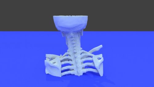 neck - stl file processed - democratiz3D® Processing - embodi3D.com