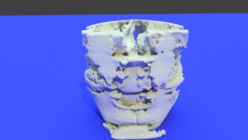 Jaw Scan - stl file processed - Dental, Orthodontic, Maxillofacial ...