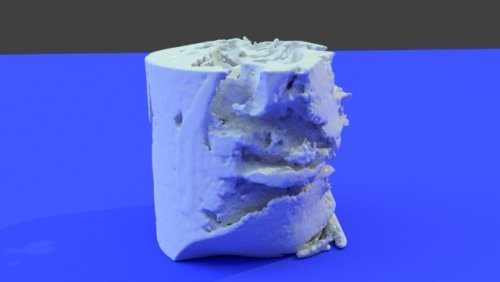 Jaw Scan - stl file processed - Dental, Orthodontic, Maxillofacial ...