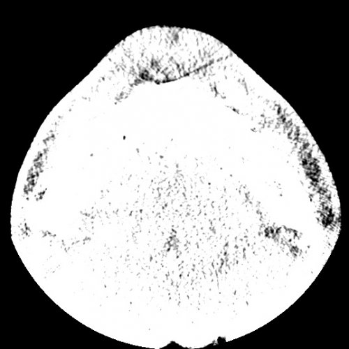 Jaw Scan - Dental, Orthodontic, Maxillofacial - embodi3D.com