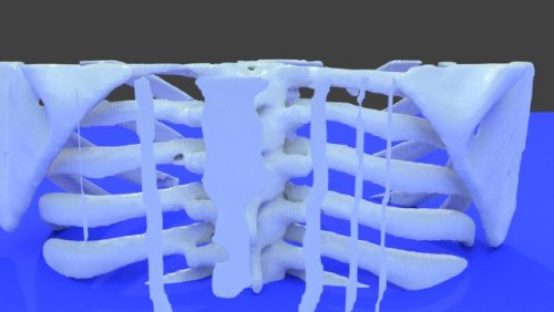 multifile1 - stl file processed - Thorax and Ribs - embodi3D.com