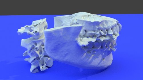 Jaws - stl file processed - Dental, Orthodontic, Maxillofacial ...