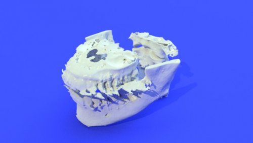 Jaws - stl file processed - Dental, Orthodontic, Maxillofacial ...