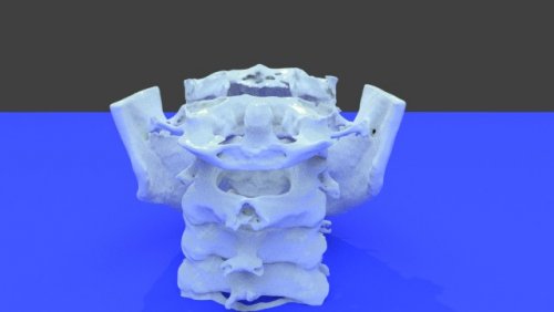 Jaws - stl file processed - Dental, Orthodontic, Maxillofacial ...