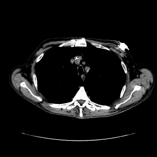 human thorex model v2 - Thorax CTs - embodi3D.com