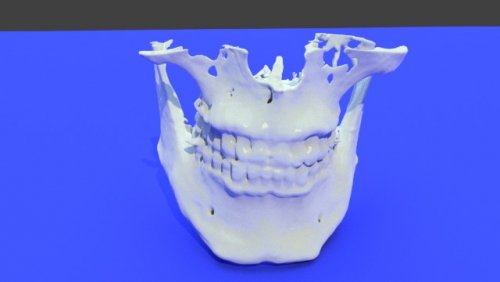 Dentistry - stl file processed - Dental, Orthodontic, Maxillofacial ...