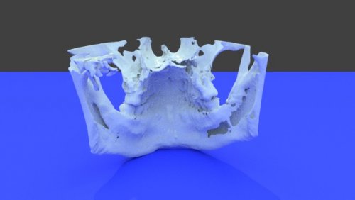 Dentistry - stl file processed - Dental, Orthodontic, Maxillofacial ...