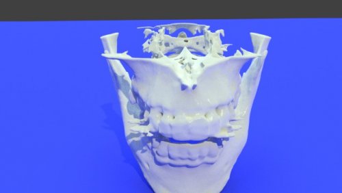 Teeth - stl file processed - Dental, Orthodontic, Maxillofacial ...