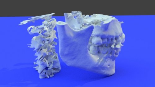 Teeth - stl file processed - Dental, Orthodontic, Maxillofacial ...