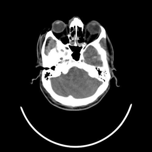 CTA for Head 6 - Skull, Head, and Neck CTs - embodi3D.com