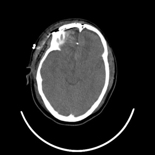 CTA for Head - Skull, Head, and Neck CTs - embodi3D.com