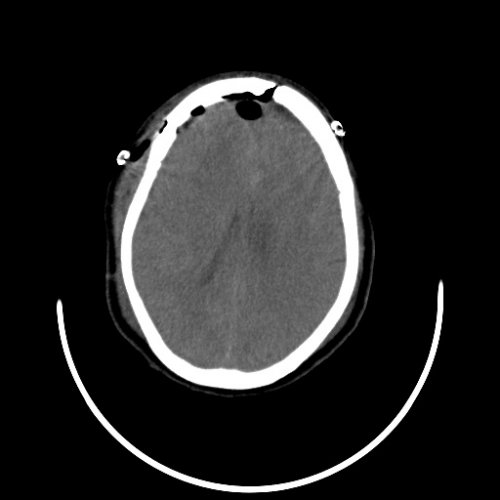 CTA for Head - Skull, Head, and Neck CTs - embodi3D.com