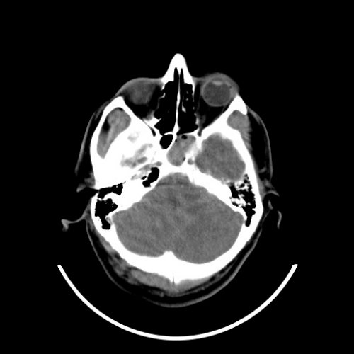 CTA for Head 7 - Skull, Head, and Neck CTs - embodi3D.com