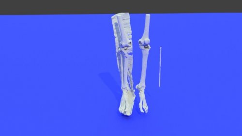 MESETA TIBIAL - stl file processed - Extremity, Lower (Leg) - embodi3D.com