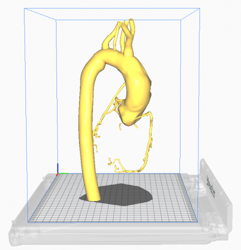 3d model of aorta and coronary arteries - Aorta - embodi3D.com