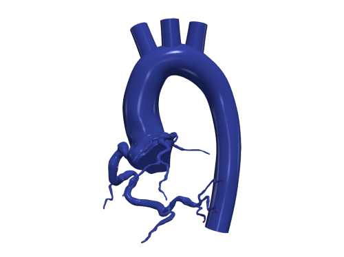 3d model of aorta and coronary arteries - Aorta - embodi3D.com