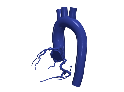 3d model of aorta and coronary arteries - Aorta - embodi3D.com