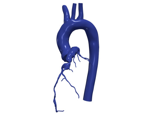3d model of aorta and coronary arteries - Aorta - embodi3D.com