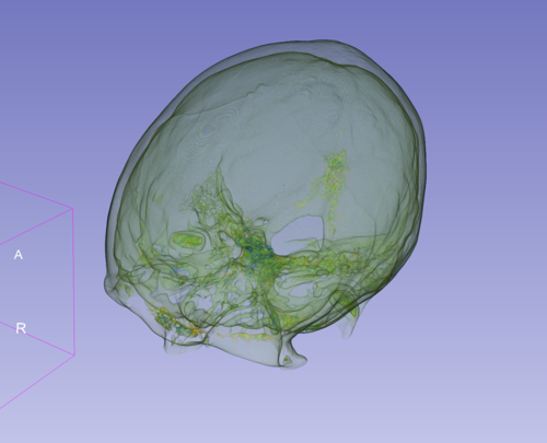 Head CT - Skull, Head, and Neck CTs - embodi3D.com