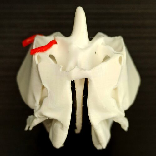 Ethmoid Bone - Skull and Face - embodi3D.com