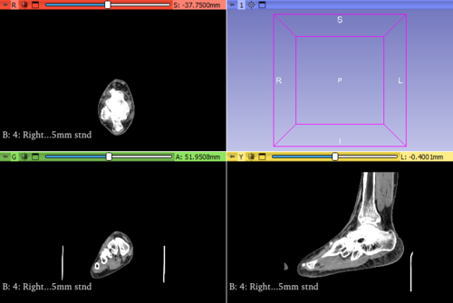 Right Ankle - democratiz3D® Processing - embodi3D.com