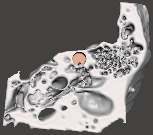 Temporal bone with all inner ear structures reconstructed from CT scan ...