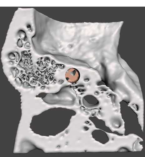 Temporal bone with all inner ear structures reconstructed from CT scan ...