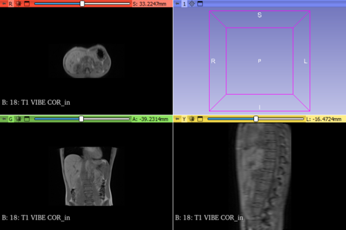 Old ct scan - democratiz3D® Processing - embodi3D.com