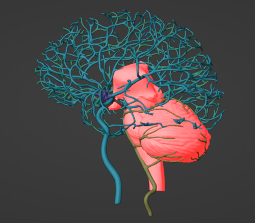 3D Model of Brain and Aneurysm - Brain - embodi3D.com