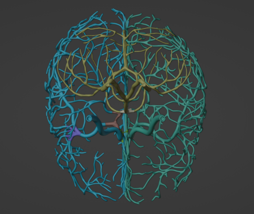3D Model of Brain and Aneurysm - Brain - embodi3D.com