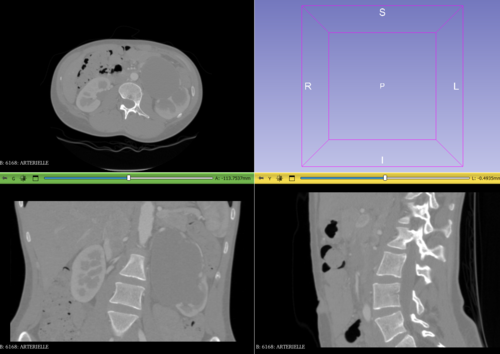 Test DICOM to NRRD - democratiz3D® Processing - embodi3D.com
