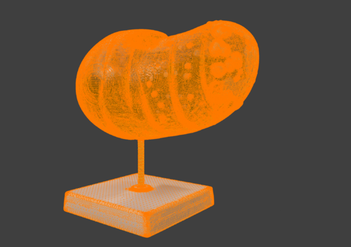3D Model of Human Liver with the Progression of Liver Disease - Other ...