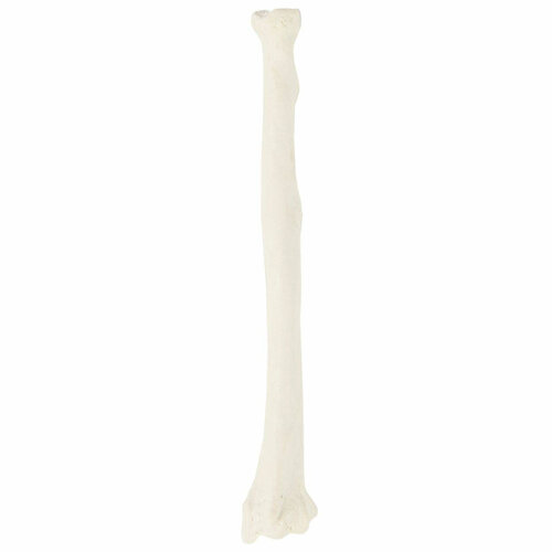 3D Model of Radius Bone - Extremity, Lower (Leg) - embodi3D.com