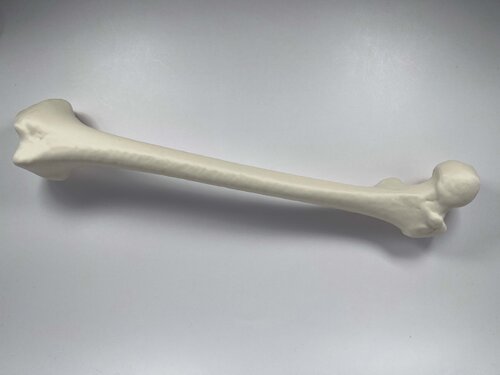 Left Human Femur from CT - Extremity, Lower (Leg) - embodi3D.com