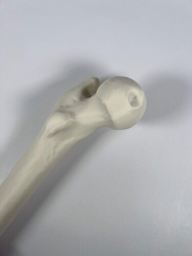 Left Human Femur from CT - Extremity, Lower (Leg) - embodi3D.com